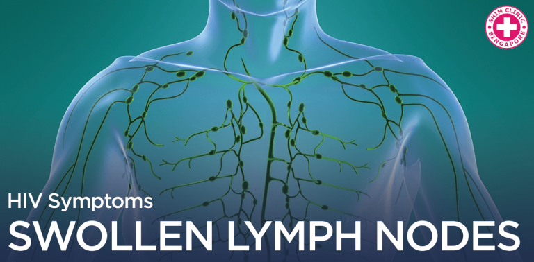 HIV Swollen Lymph Nodes Singapore | HIV Swollen Lymph Nodes | Shim Clinic